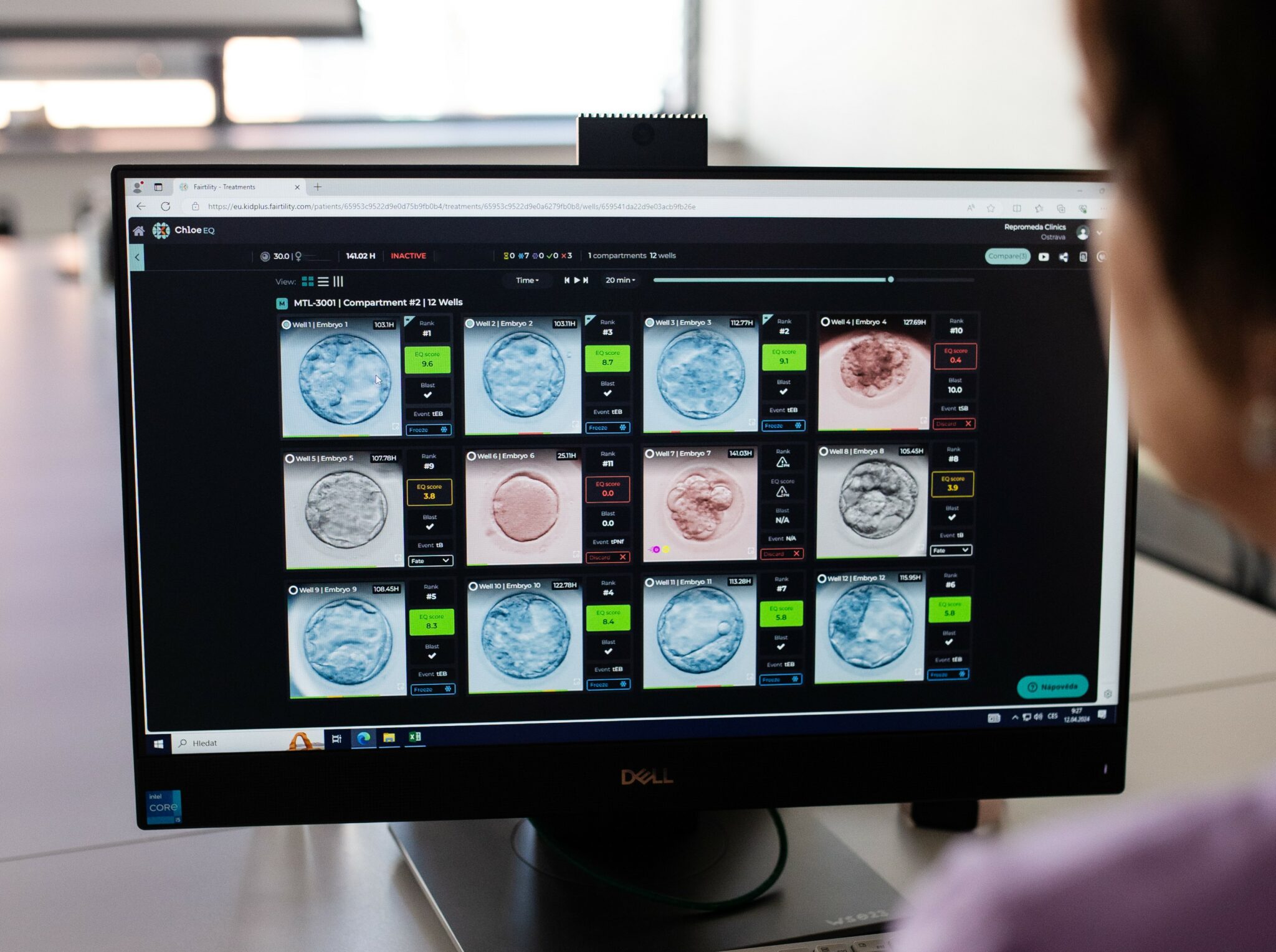 Embryo Quality Assessment – How to Choose the Right One? | Repromeda